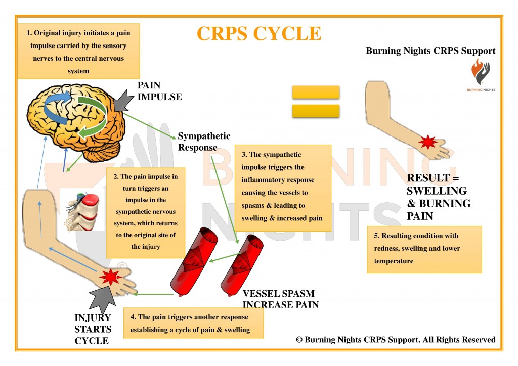 What Is CRPS Or RSD 